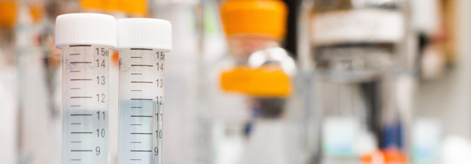 DUTCH Testing for Hormone Imbalances